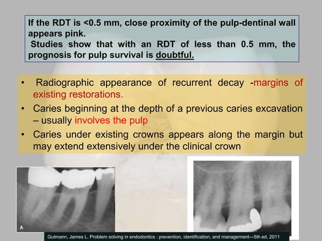 CLINICAL DIAGNOSIS OF ENDODONTIC PATHOSIS | PPT | Dental Health ...