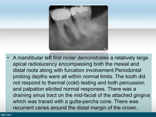 CLINICAL DIAGNOSIS OF ENDODONTIC PATHOSIS | PPT