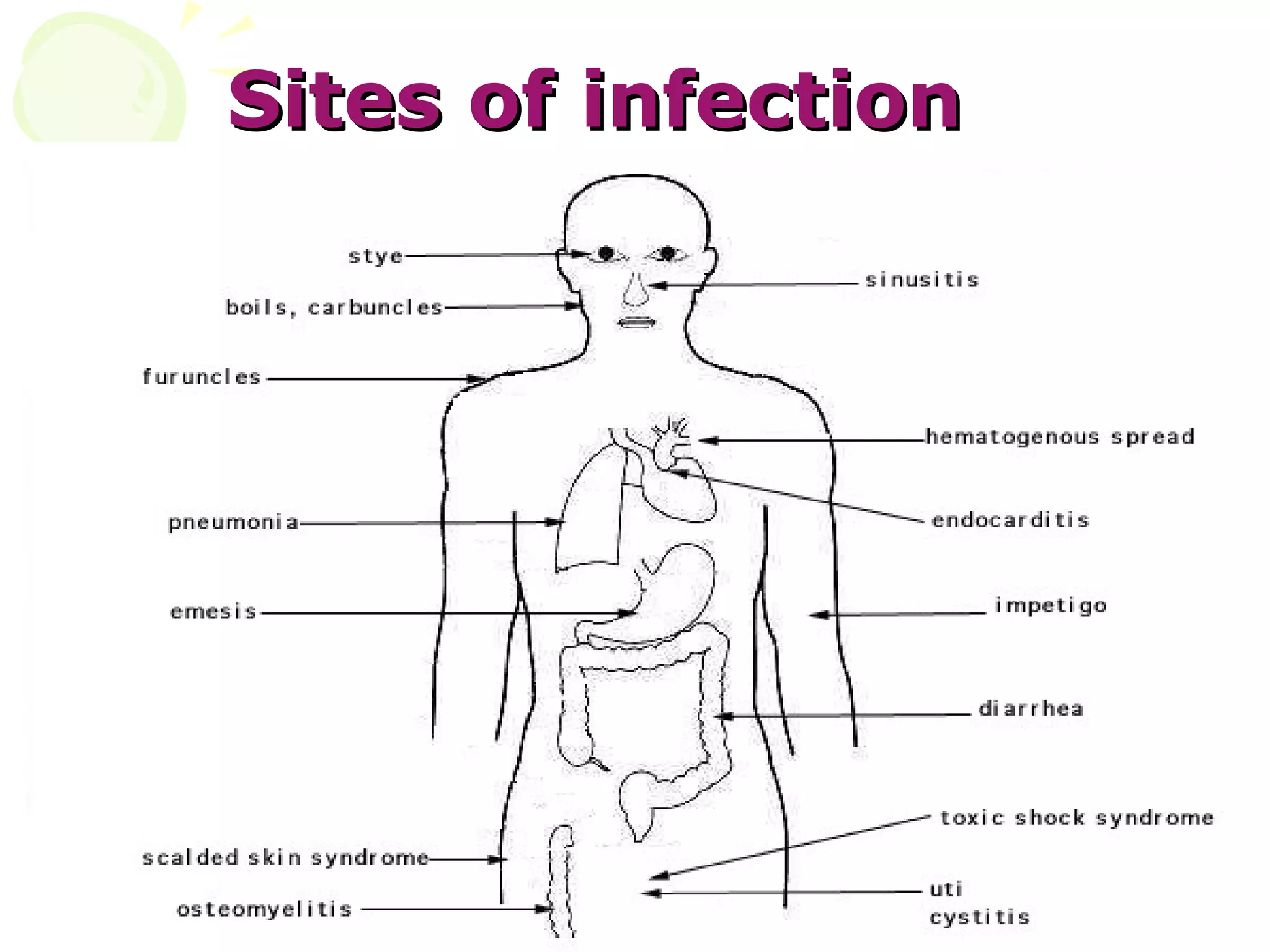 Diagnosis of mrsa by molecular methods | PPT