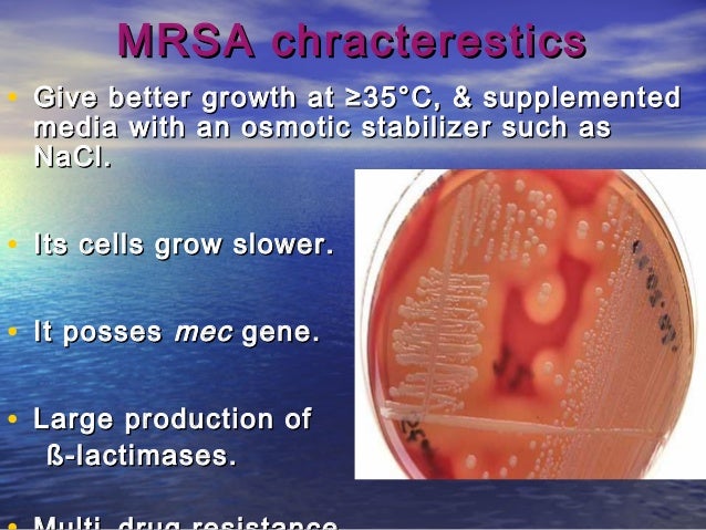 Mrsa Super Bug Symptoms Risk Factors Diagnosis