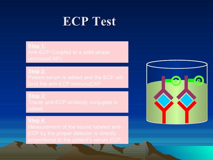 Diagnoisis of allergy in children