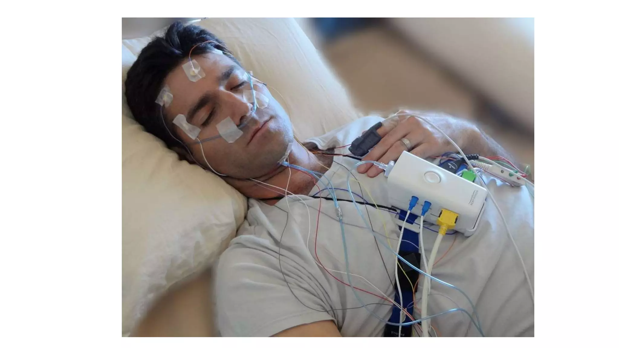 Diagnois Obstructive Sleep Apnoea Ppt 0632
