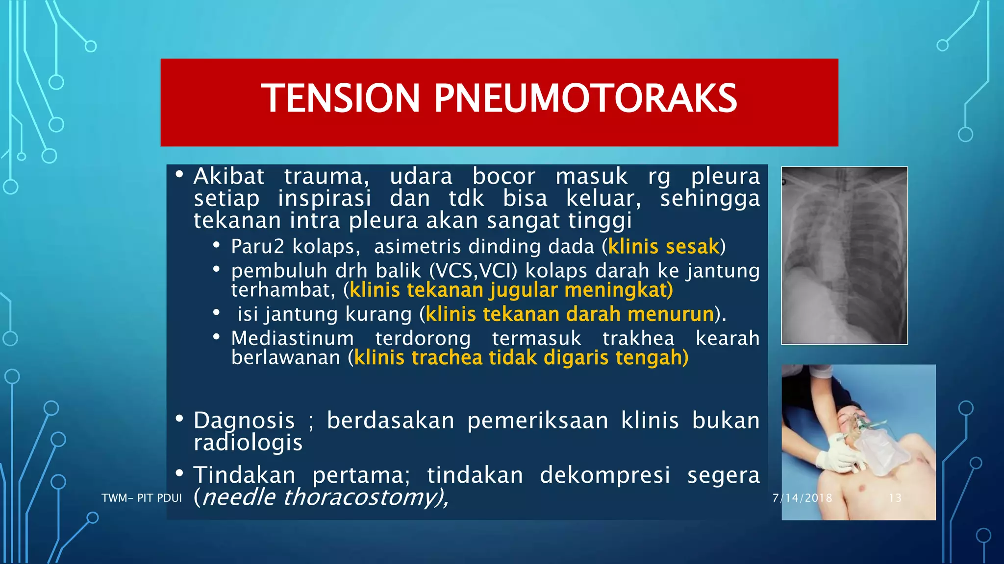 Diagnosa-dan-tatalaksana-trauma-torax-dan-abdomen.pptx