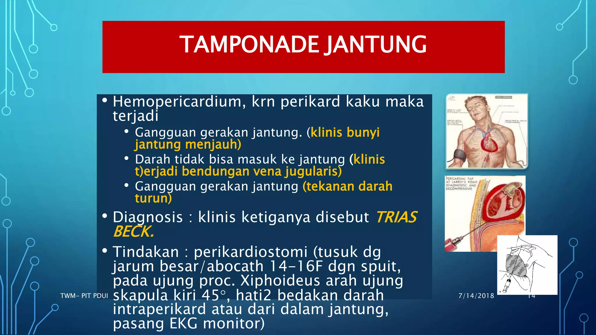 Diagnosa-dan-tatalaksana-trauma-torax-dan-abdomen.pptx