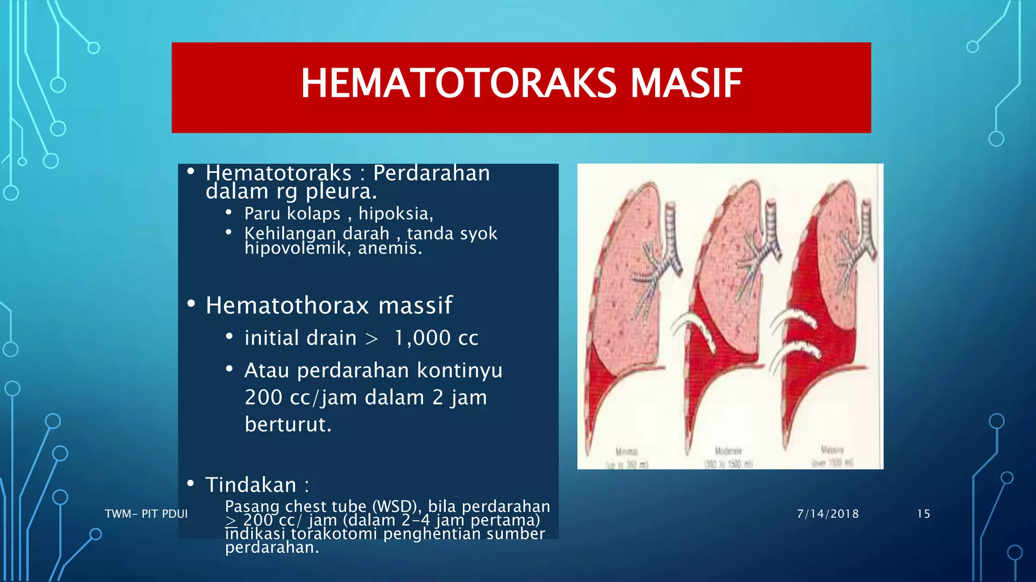 Diagnosa-dan-tatalaksana-trauma-torax-dan-abdomen.pptx