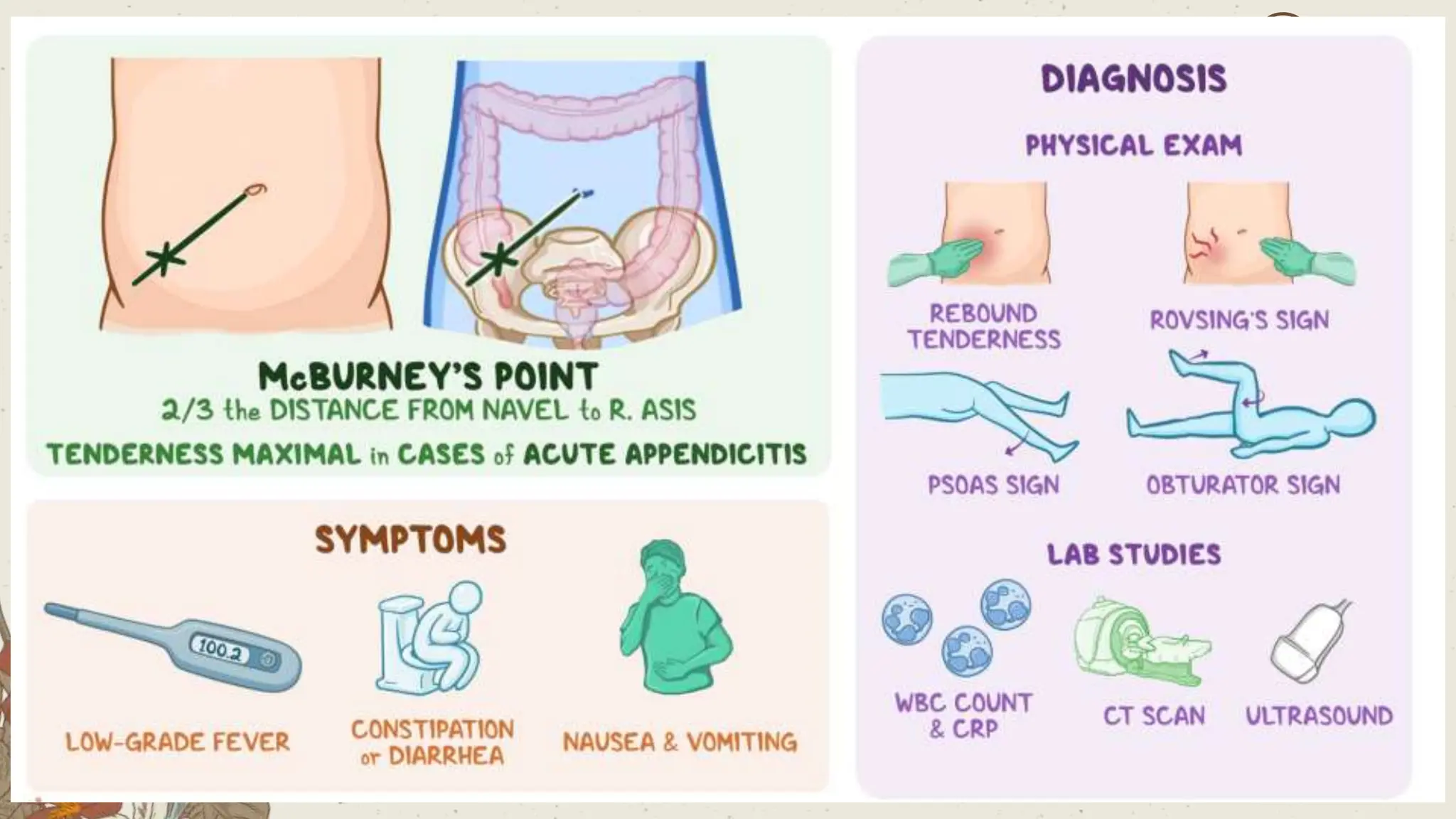 Diagnosa dan Tatalaksana Appendicitis Akut | PPTX