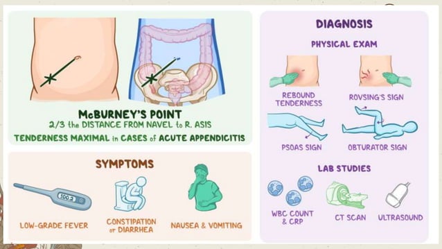 Diagnosa dan Tatalaksana Appendicitis Akut | PPTX