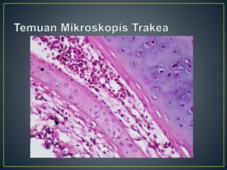 Diagnosa morfologis ayam buras | PPT