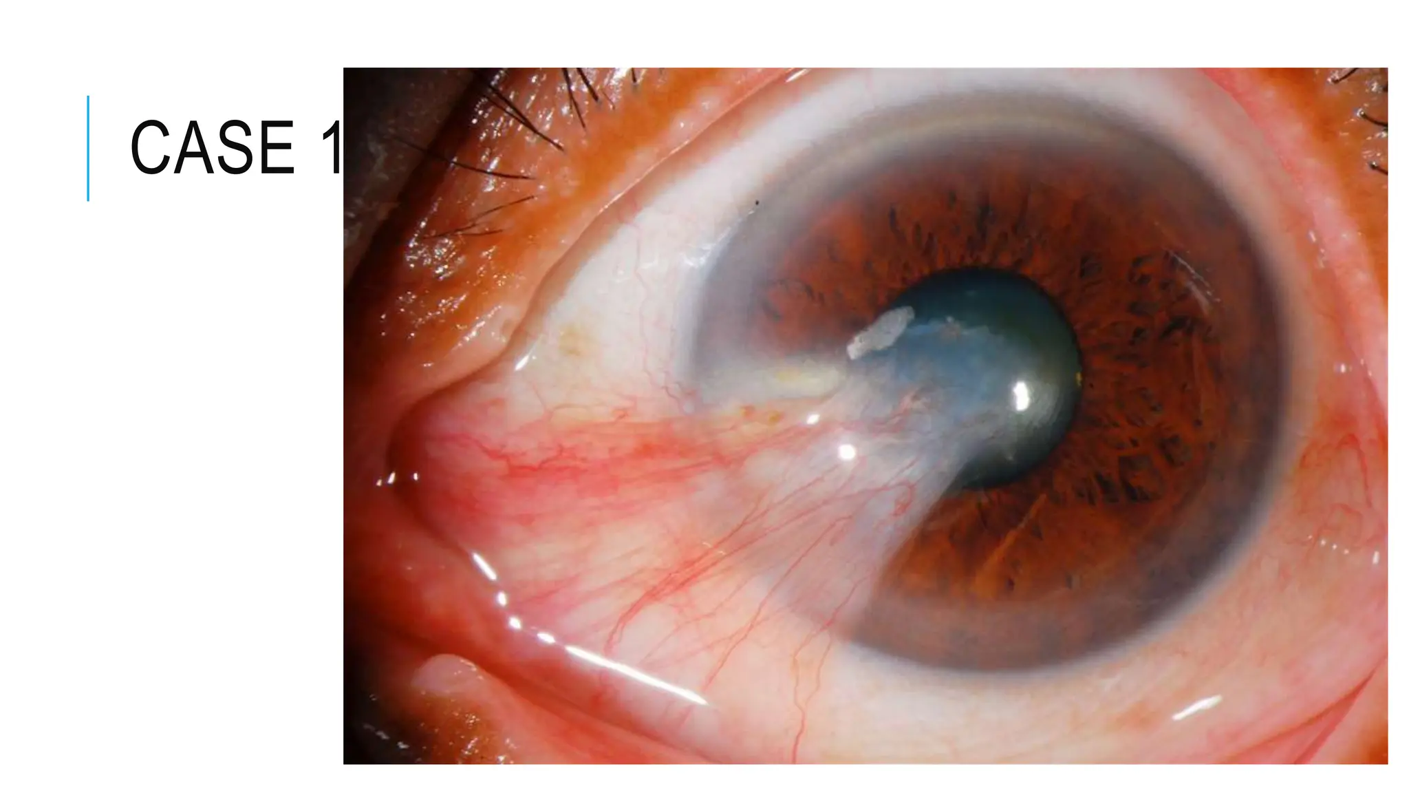 Diagnose This - some common ocular conditions | PPT
