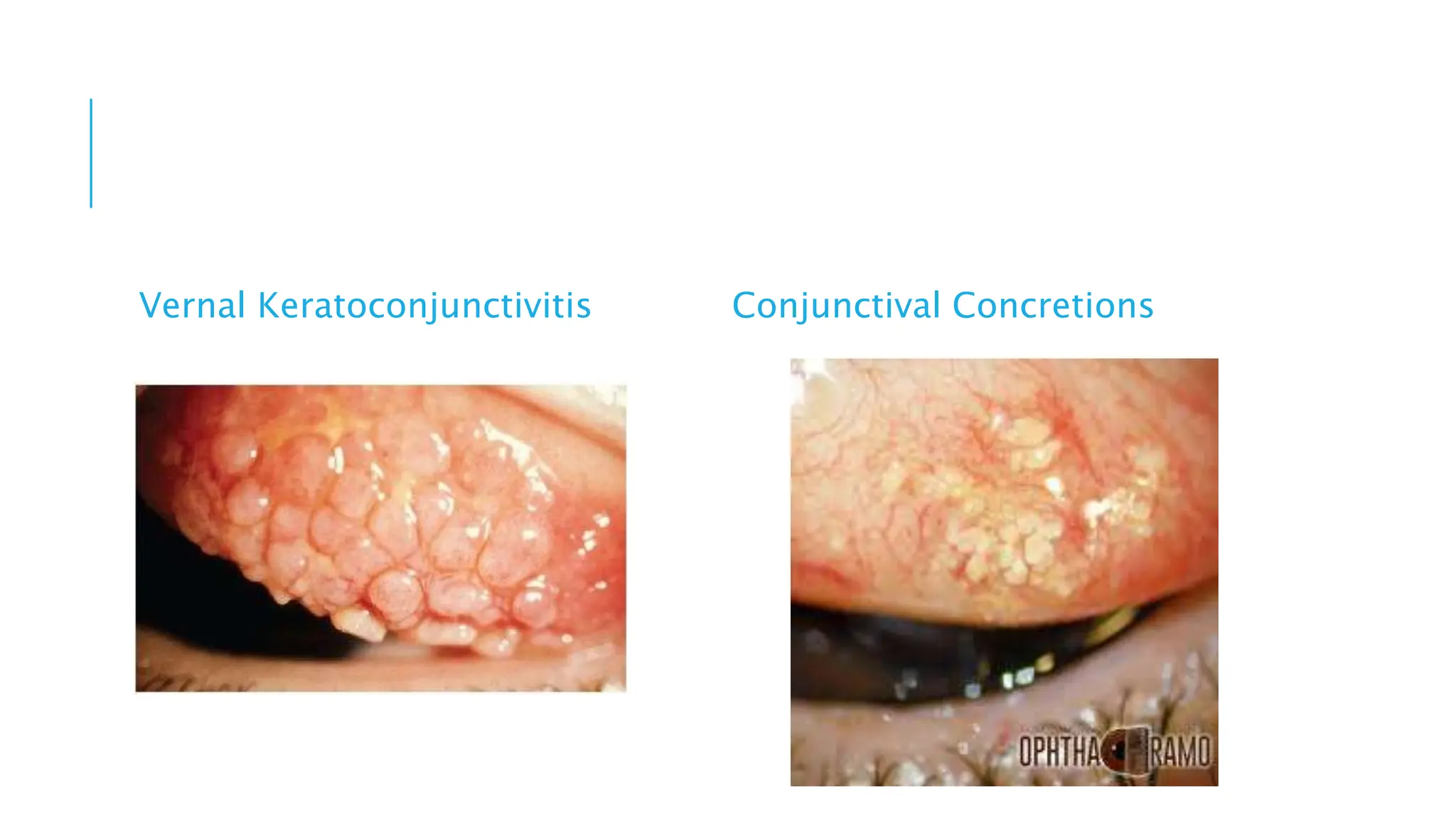 Diagnose This - some common ocular conditions | PPT