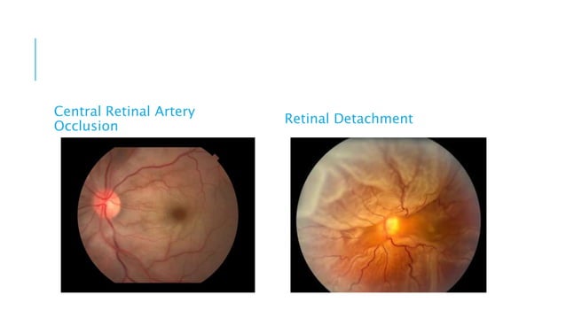 Diagnose This - some common ocular conditions | PPT