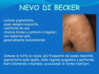 Diagnosi lesioni cutanee | PPT