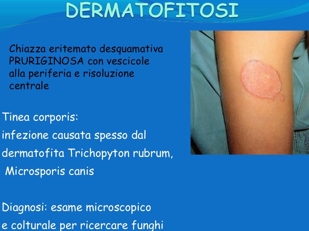 Diagnosi lesioni cutanee