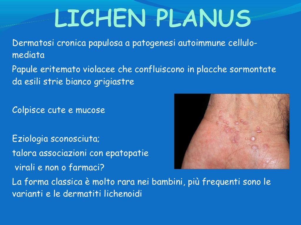 Diagnosi lesioni cutanee