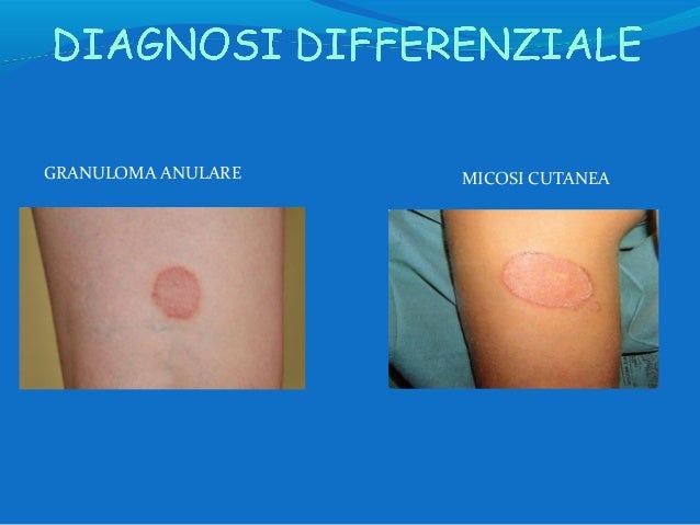 Diagnosi lesioni cutanee