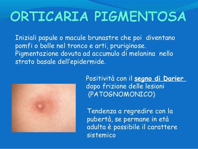 Diagnosi lesioni cutanee