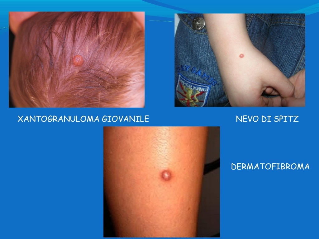 Diagnosi lesioni cutanee