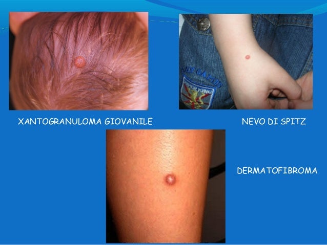 Diagnosi lesioni cutanee