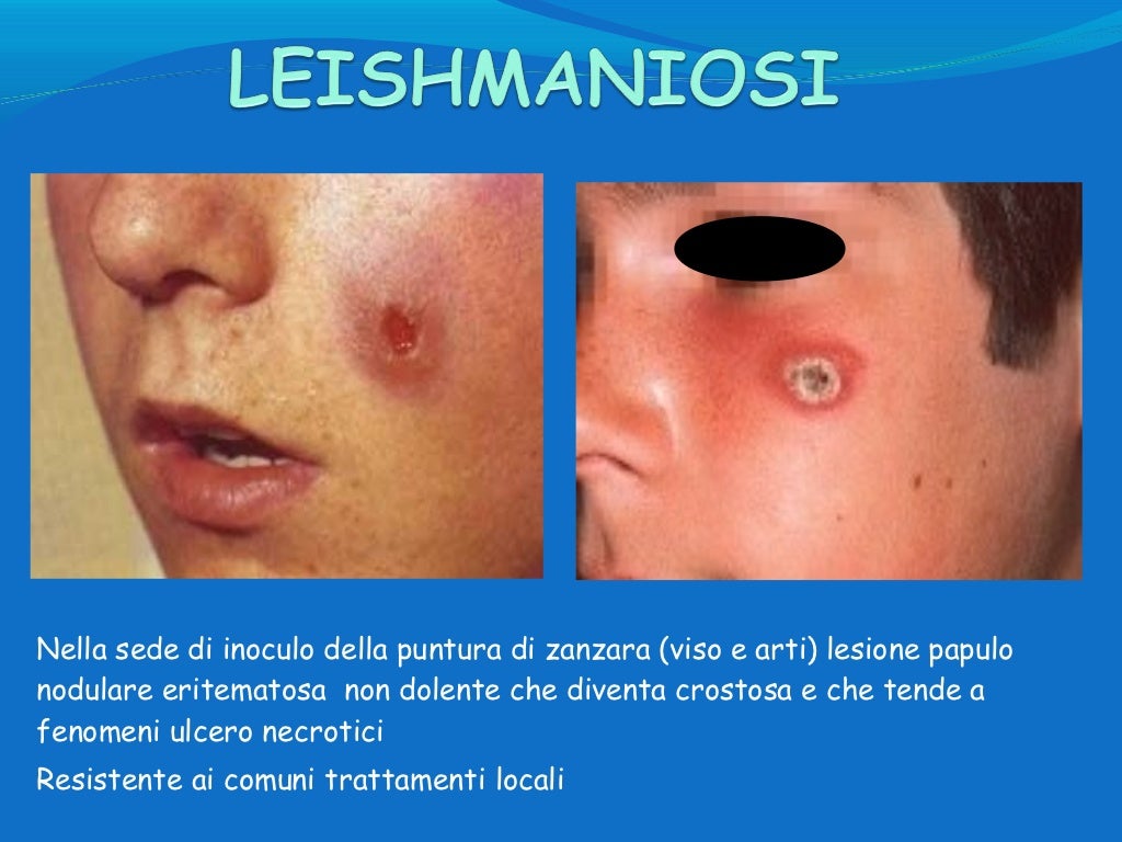 Diagnosi lesioni cutanee