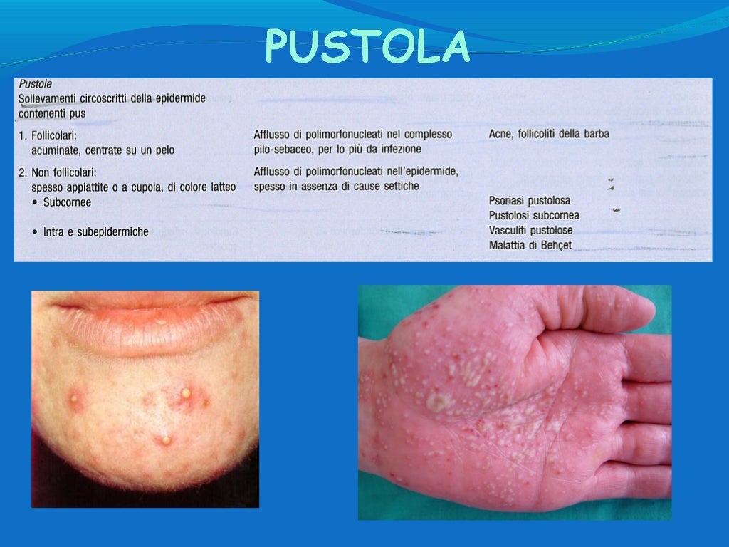 Diagnosi lesioni cutanee
