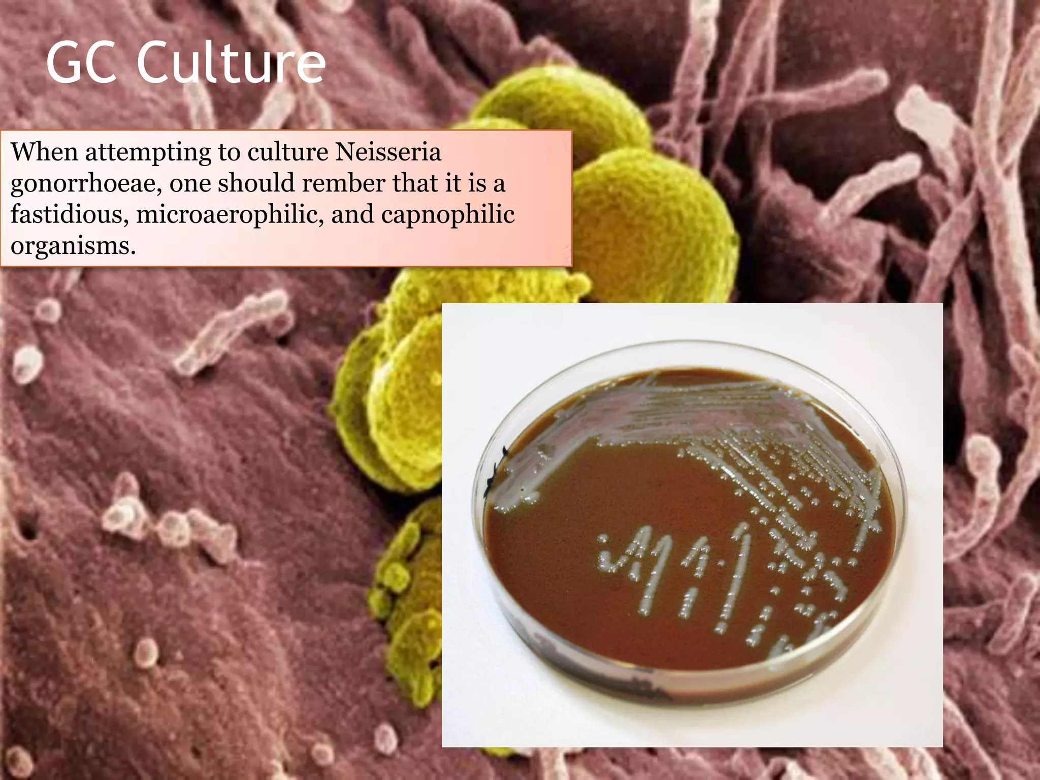 Chapter 13 Diagnosing Infectious Diseases | PPTX