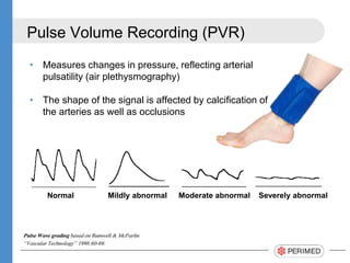 Diagnosing peripheral arterial disease and assessing degree of ischemia ...