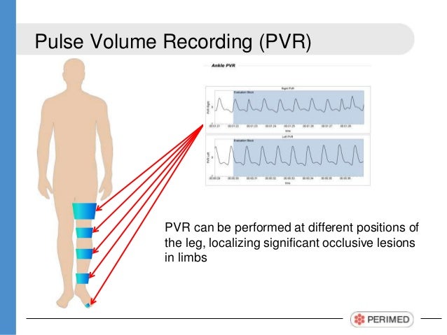 Diagnosing peripheral arterial disease and assessing degree of ischem…