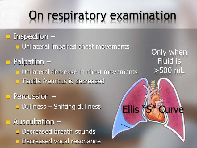 Diagnosing pleural effusion