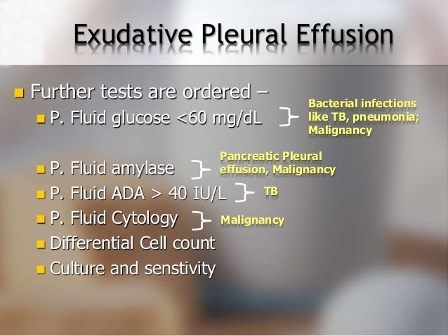 Diagnosing pleural effusion