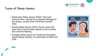 Understanding Sleep Apnea: How Pulmonologist Diagnose and Treat It | PDF