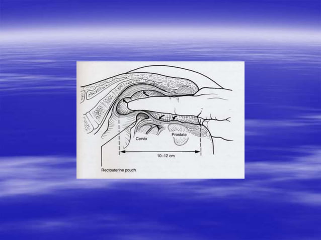 Diagnosi proctologica1.ppt