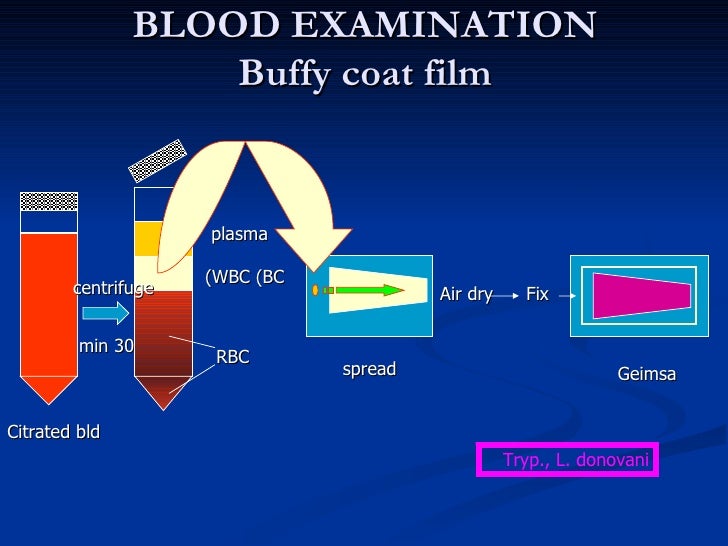 Quantitative Buffy Coat Qbc Test Principle Method And