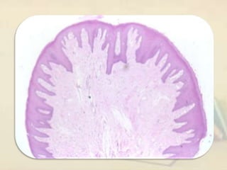 Exophytic lesion in the oral cavity | PPT