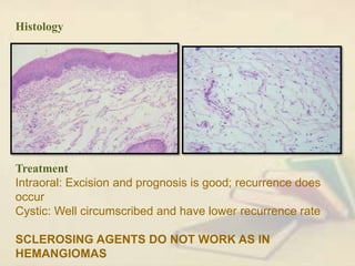Exophytic lesion in the oral cavity | PPT