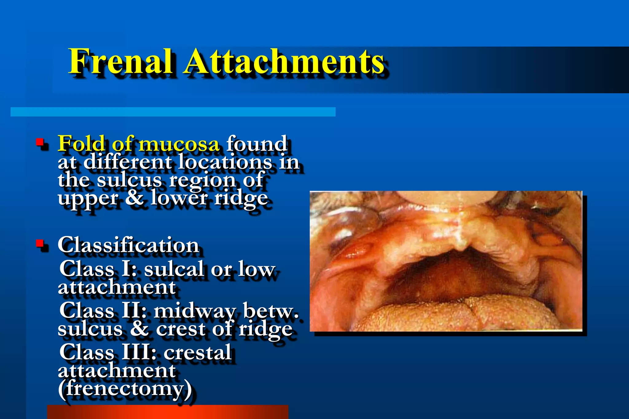 Diagnosis & treatment plan of completely Edentulous Patients | PPTX