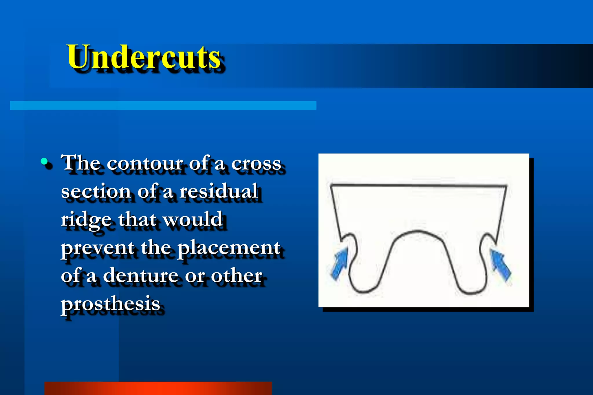 Diagnosis & treatment plan of completely Edentulous Patients | PPTX