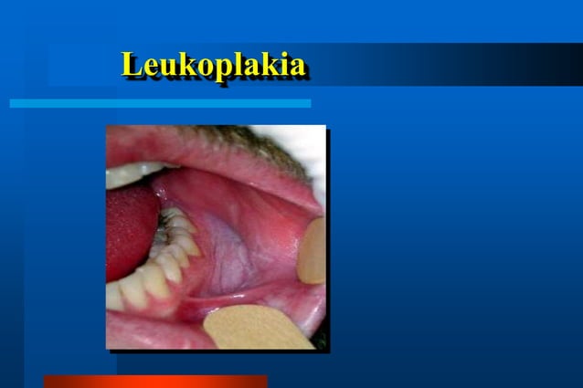 Diagnosis & treatment plan of completely Edentulous Patients | PPTX