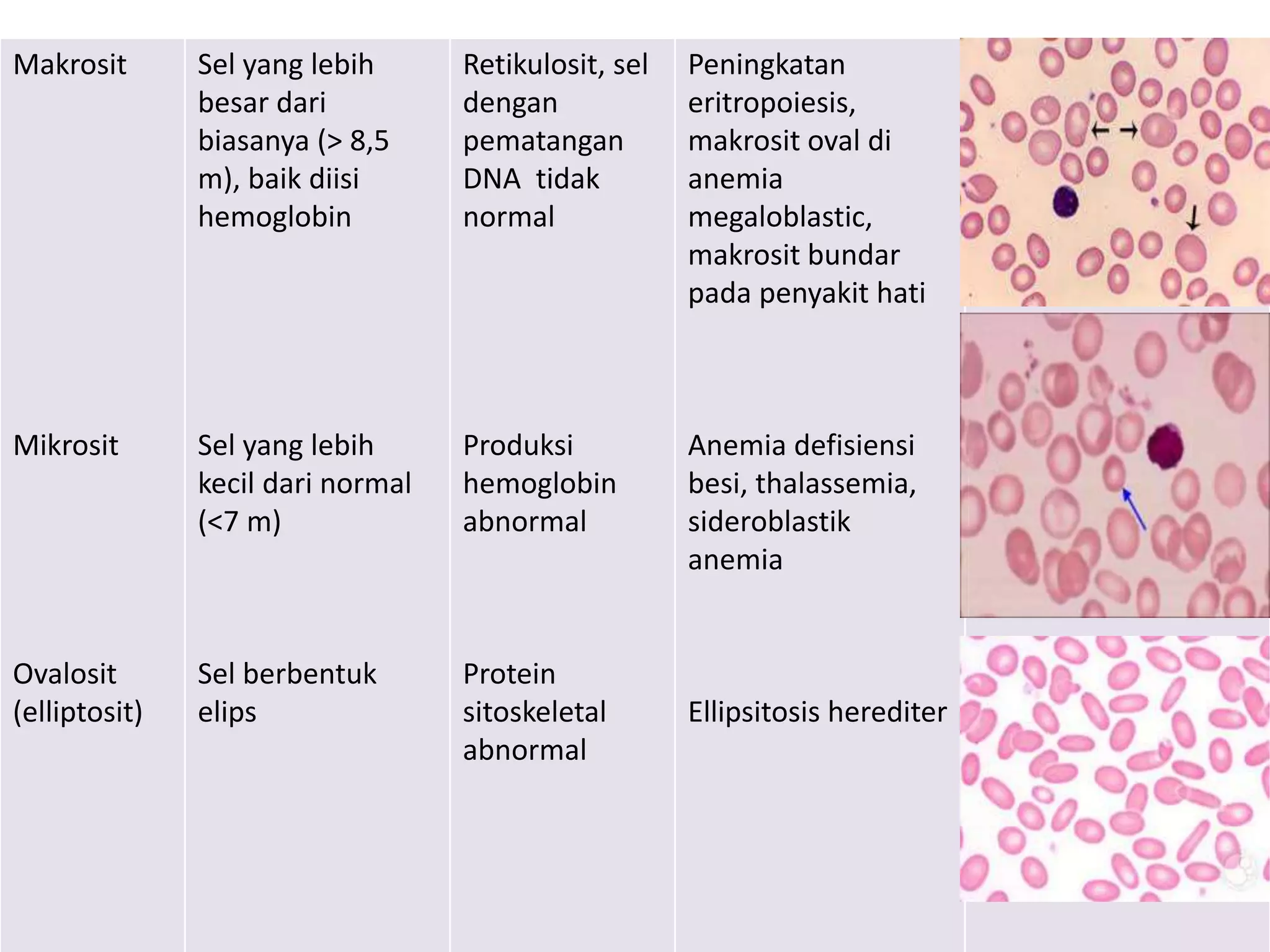 Diagnosis anemia-anak -ppt (1) | PPTX