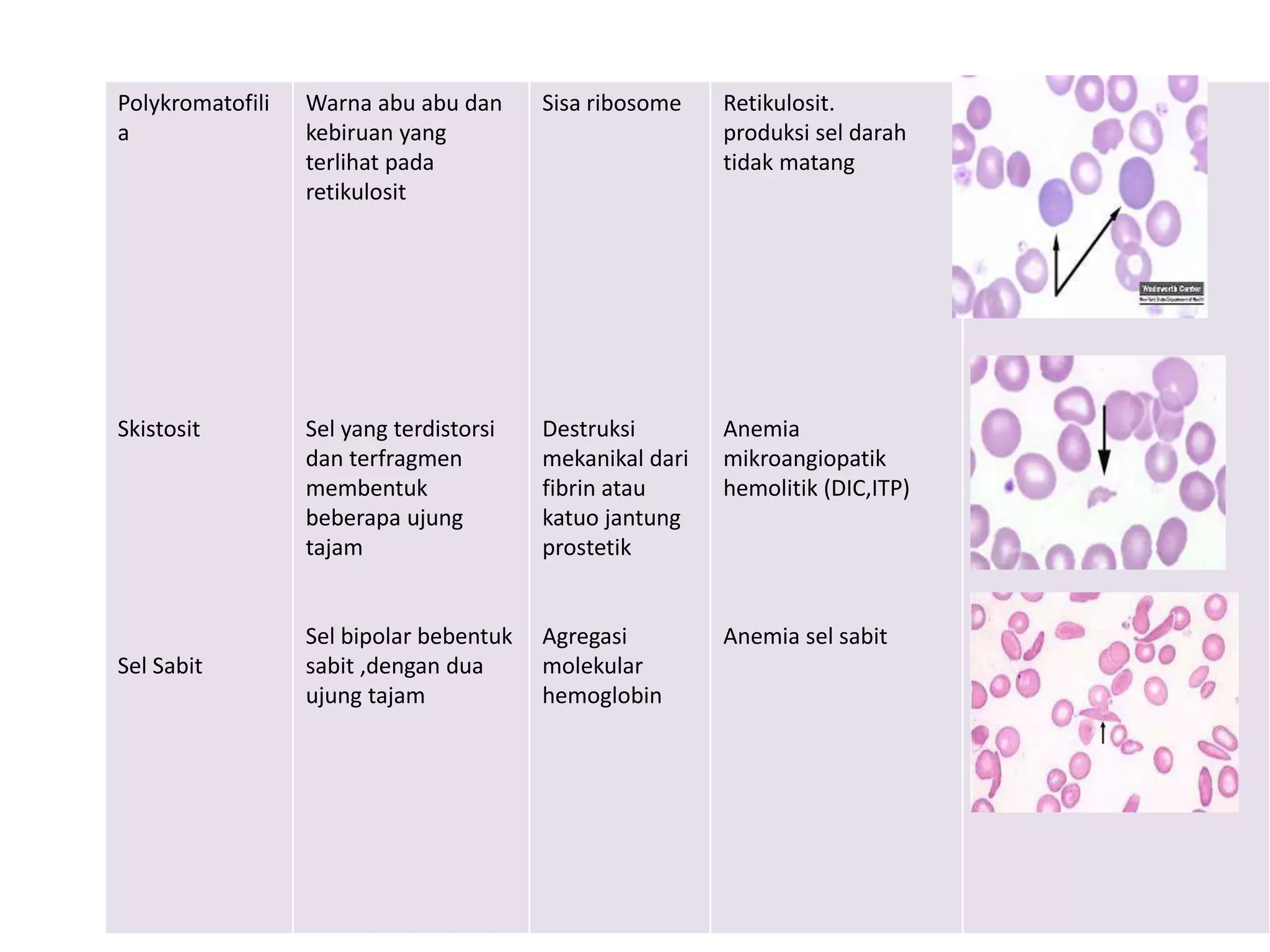 Diagnosis anemia-anak -ppt (1) | PPTX
