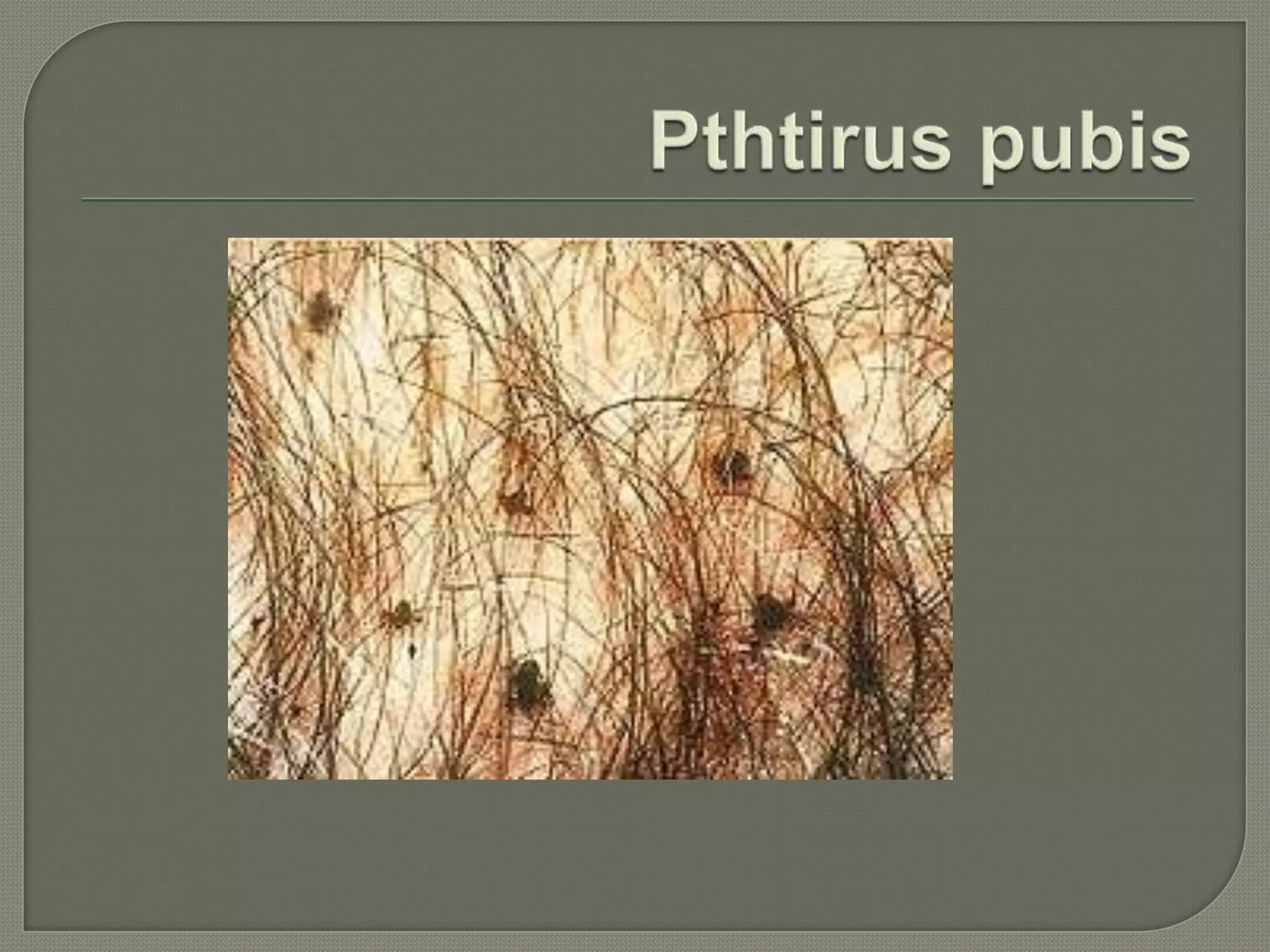 Diagnosis banding kudisan | PPTX