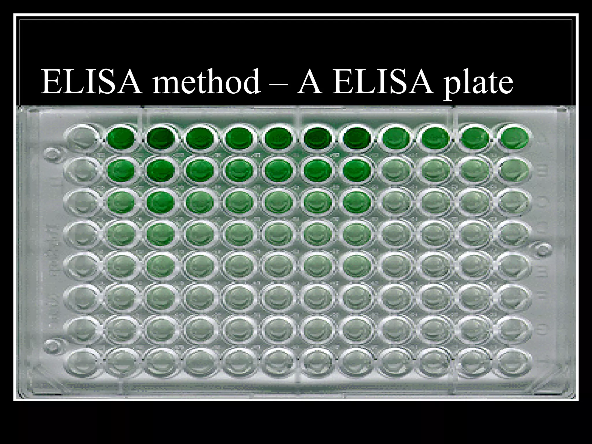 Diagnosis of-aids | PDF