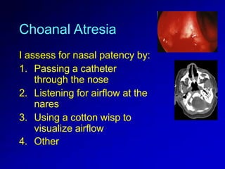 Diagnosis-of-ent-disorders-you-make-the-call.pptx