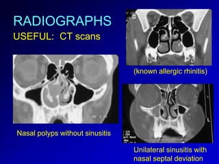 Diagnosis-of-ent-disorders-you-make-the-call.pptx