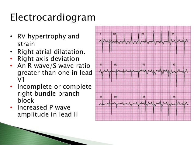 Diagnosis of Pulmonary Hypertension