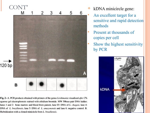 Diagnosis and Characterization of Leishmania Species Using PCR-RFLP | PPT