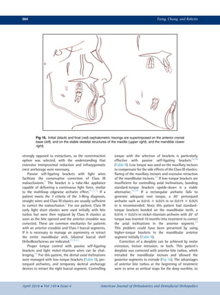 Diagnosis and conservative treatment of skeletal | PDF