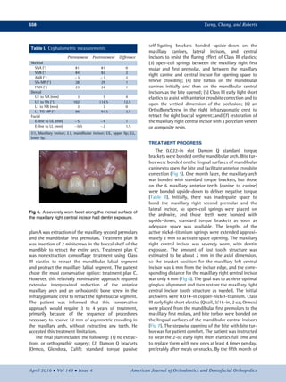 Diagnosis and conservative treatment of skeletal | PDF