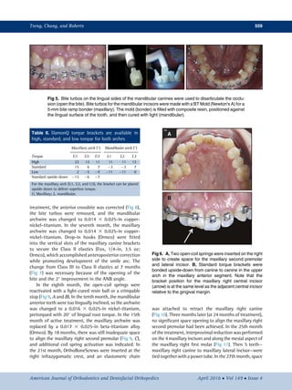 Diagnosis and conservative treatment of skeletal | PDF