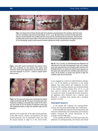 Diagnosis and conservative treatment of skeletal | PDF