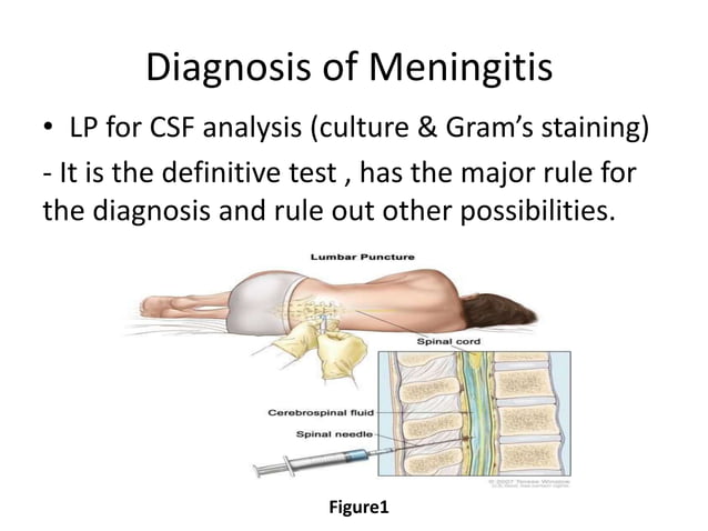 Diagnosis and differential diagnosis of Meningitis.pptx